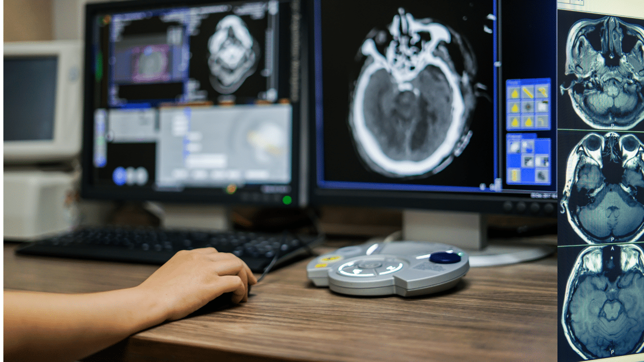 Tech for Early Disease Detection: Advances & Innovations - Technologic ...